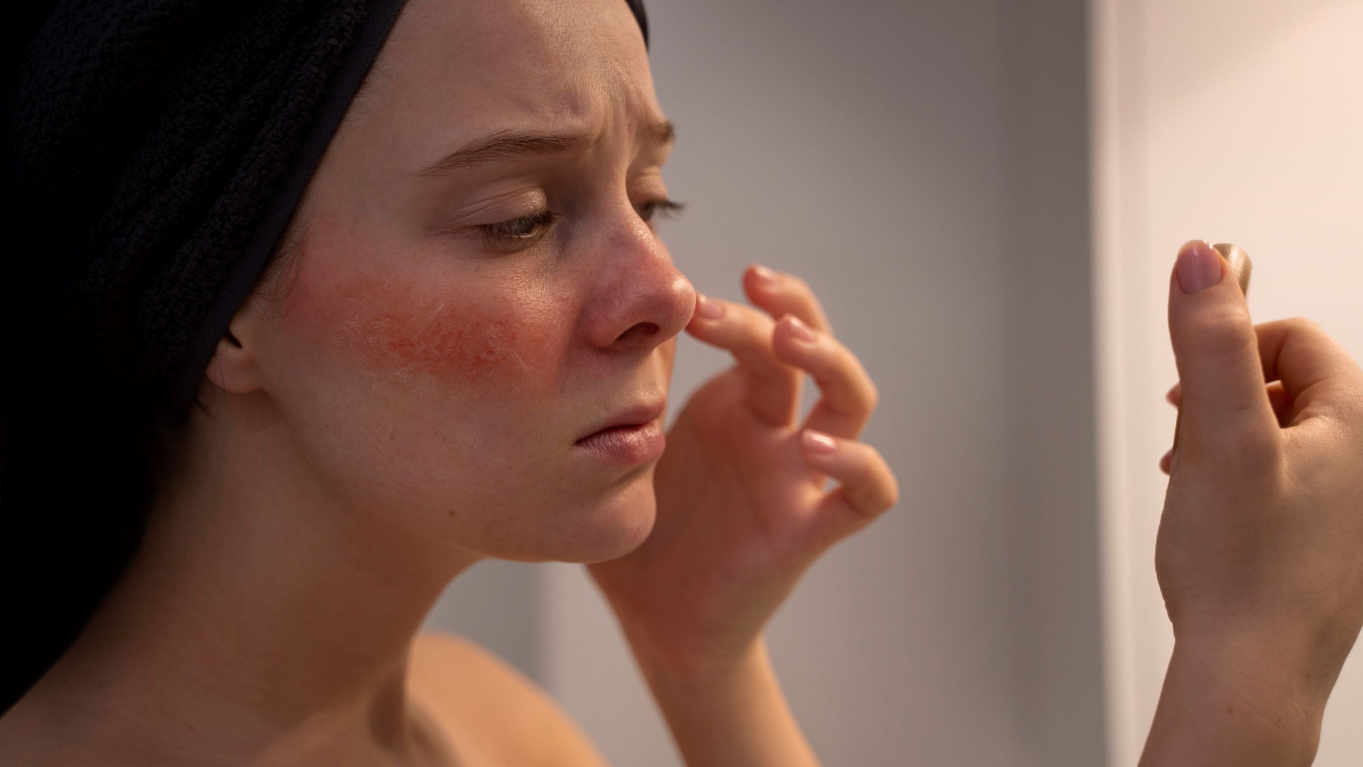 Redness Prone – The Mango Flamingo